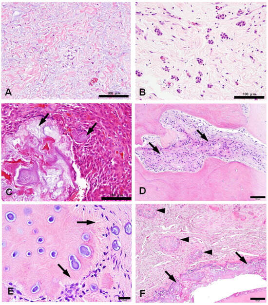 JDB | Free Full-Text | Developmental Anomalies in Human Teeth ...
