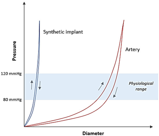 Medical Textiles as Vascular Implants and Their Success to Mimic ...