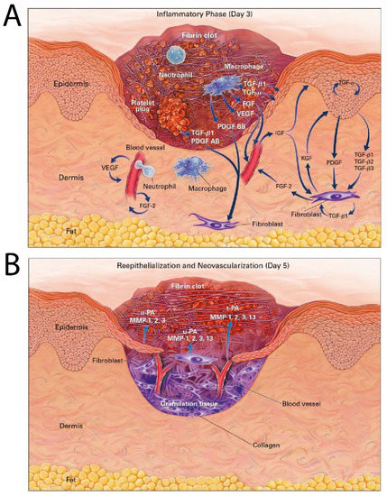 JFB | Free Full-Text | Electrical Stimulation to Enhance Wound Healing