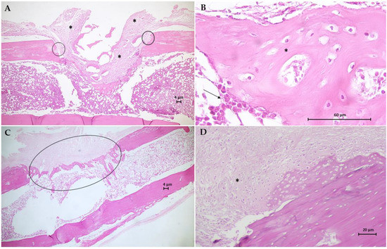 Nanocomposite Hydrogel Produced from PEGDA and Laponite for Bone ...