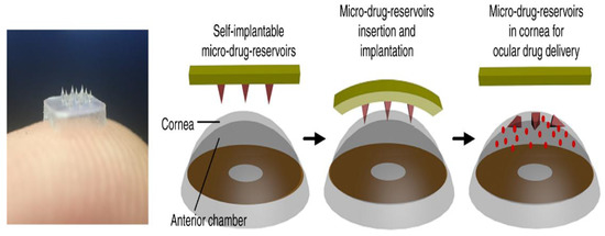 The Rise of Polymeric Microneedles: Recent Developments, Advances ...