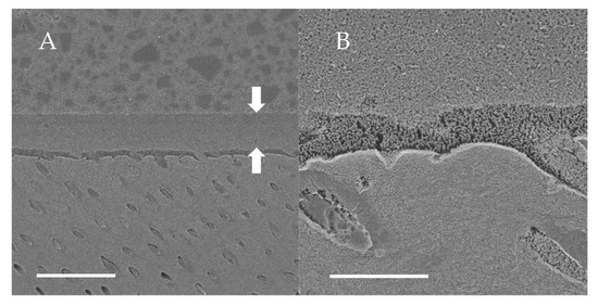 Bond Durability of Two-Step HEMA-Free Universal Adhesive