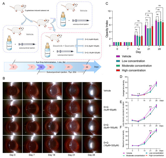 Reduction in Lens Epithelial Cell Senescence Burden through Dasatinib ...