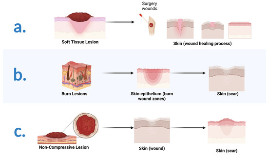 Gelatin and Bioactive Glass Composites for Tissue Engineering: A Review