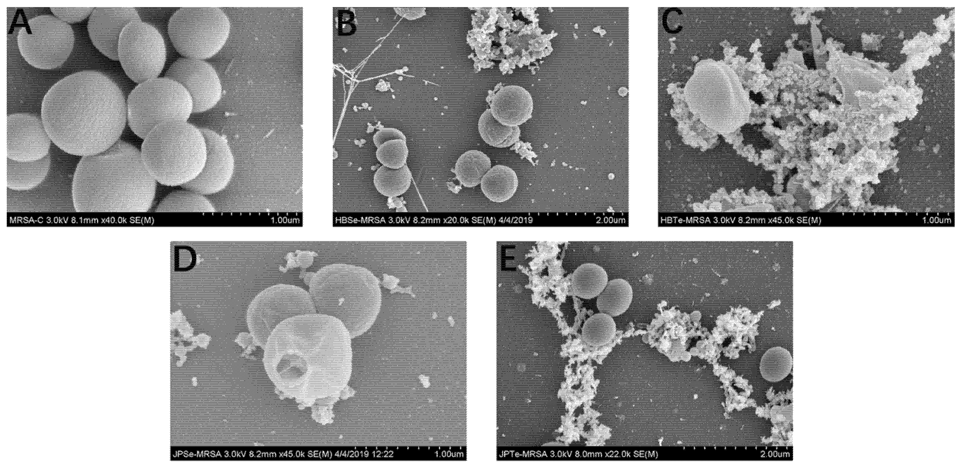 JFB | Free Full-Text | Pepper-Mediated Green Synthesis of Selenium and Tellurium Nanoparticles ...