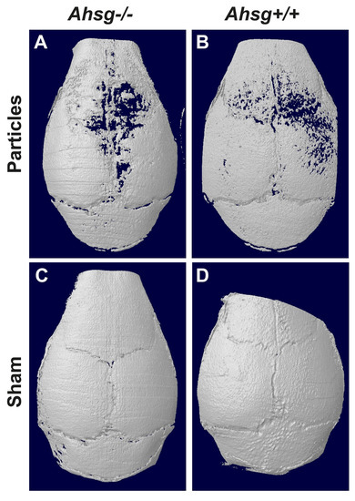 Increased UHMWPE Particle-Induced Osteolysis in Fetuin-A-Deficient Mice