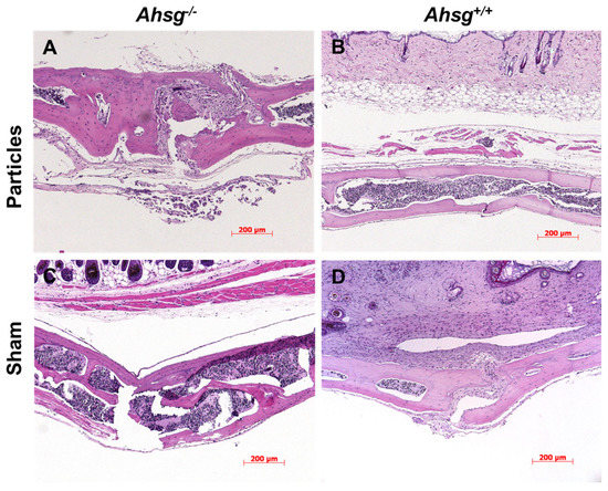 Increased UHMWPE Particle-Induced Osteolysis in Fetuin-A-Deficient Mice