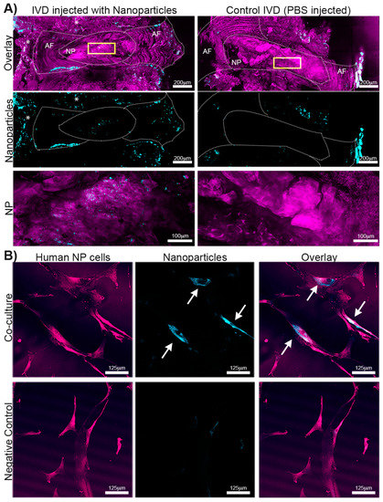 JFB | Free Full-Text | Novel Injectable Fluorescent Polymeric ...