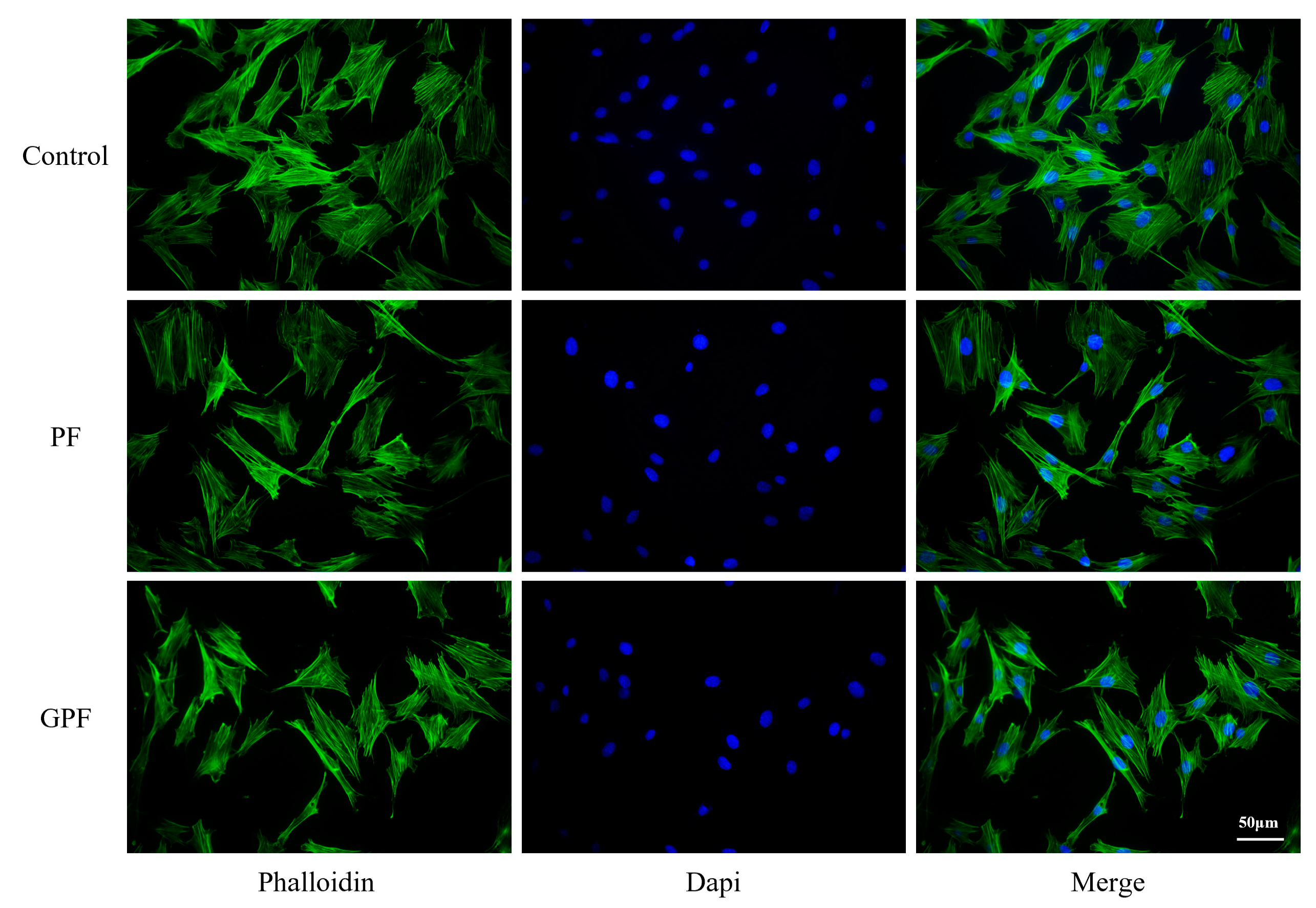 3D-Printed GelMA/PEGDA/F127DA Scaffolds for Bone Regeneration