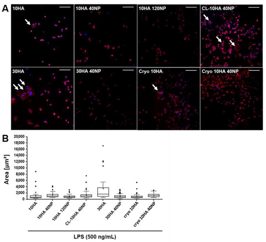 Ketoprofen-Based Polymer-Drug Nanoparticles Provide Anti-Inflammatory ...