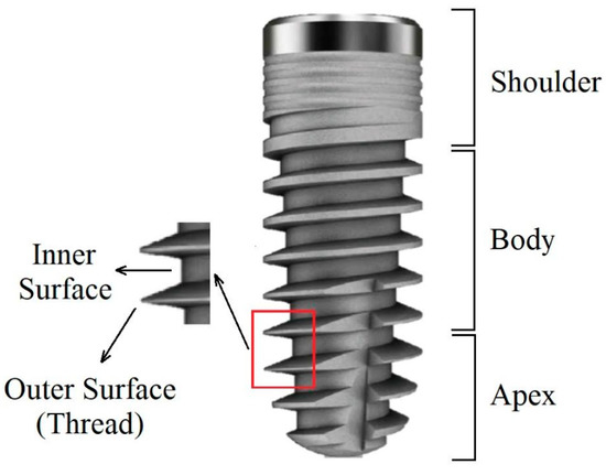 JFB | Free Full-Text | Assessing the Cleanliness of Dental Implants ...