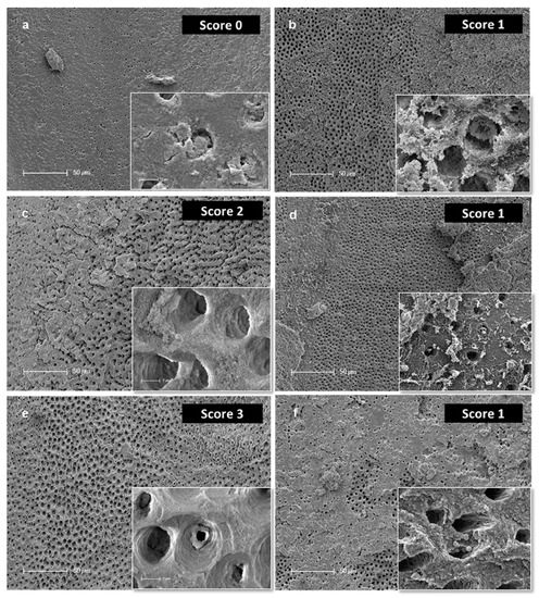 Efficacy of Endodontic Disinfection Protocols in an E. faecalis Biofilm ...