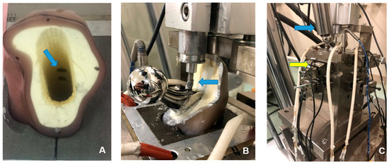 JFB | Free Full-Text | Collarless Polished Tapered Stems of Identical ...