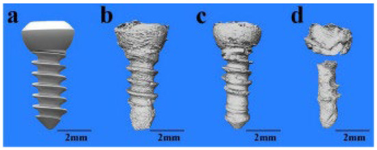 Magnesium-Based Temporary Implants: Potential, Current Status ...