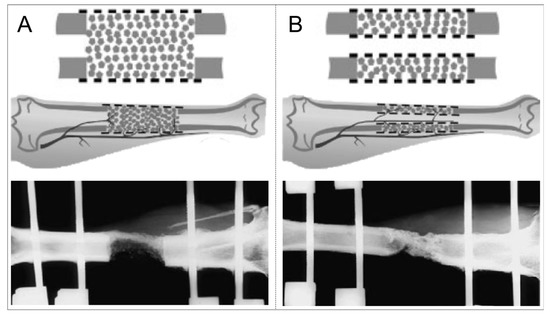 The Concept of Scaffold-Guided Bone Regeneration for the Treatment of ...