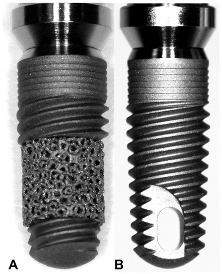Osseointegration of Tantalum Trabecular Metal in Titanium Dental ...