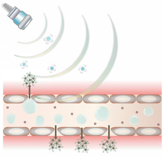 Bubble-Based Drug Delivery Systems: Next-Generation Diagnosis to Therapy