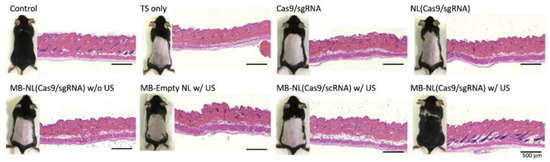 Bubble-Based Drug Delivery Systems: Next-Generation Diagnosis to Therapy