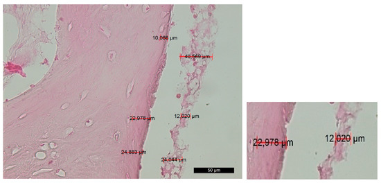 Effect of Er:YAG Laser Exposure on the Amorphous Smear Layer in the ...