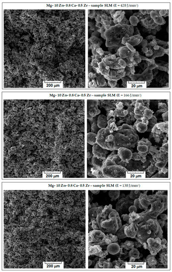 Biodegradable Magnesium Alloys for Personalised Temporary Implants