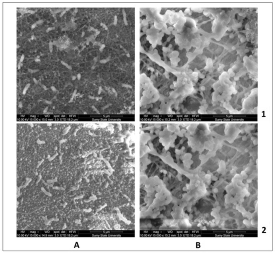JFB | Free Full-Text | Fabrication and Characterization of Electrospun Chitosan/Polylactic Acid ...