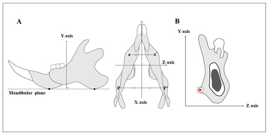 Effect of the Correction of Bilateral Differences in Masseter Muscle ...