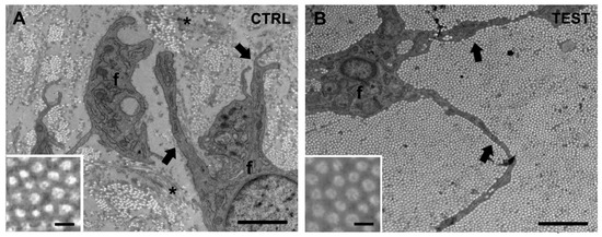 Electron Microscopy (EM) Analysis of Collagen Fibers in the Peri ...