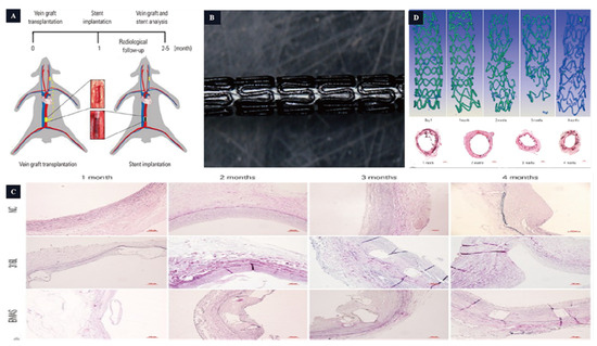 Research on the Current Application Status of Magnesium Metal Stents in ...