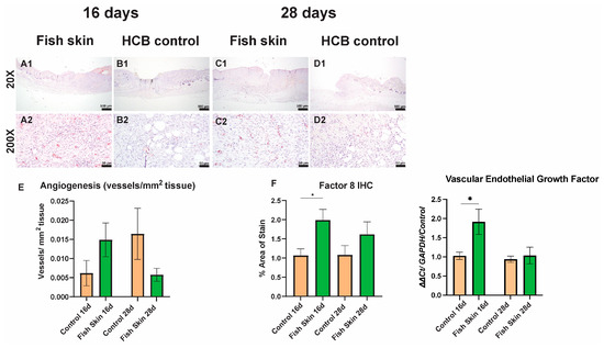 Tilapia Fish Skin Treatment of Third-Degree Skin Burns in Murine Model