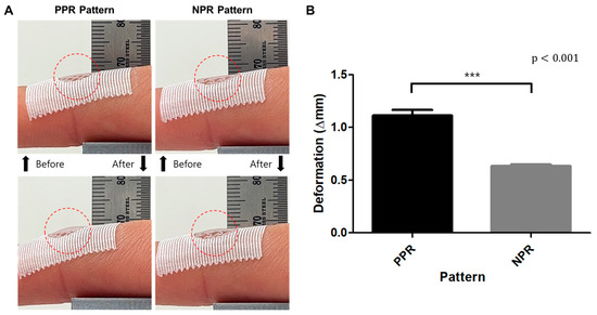 3D-Printed Auxetic Skin Scaffold for Decreasing Burn Wound Contractures ...