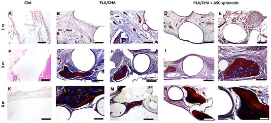 A Synergic Strategy: Adipose-Derived Stem Cell Spheroids Seeded on 3D ...
