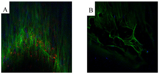 Titanium Biohybrid Middle Ear Prostheses: A Preliminary In Vitro Study