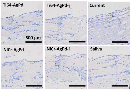 JFB | Free Full-Text | Oral Galvanism Side Effects: Comparing Alloy ...