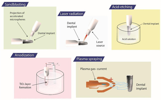 Biomimetic Coatings in Implant Dentistry: A Quick Update