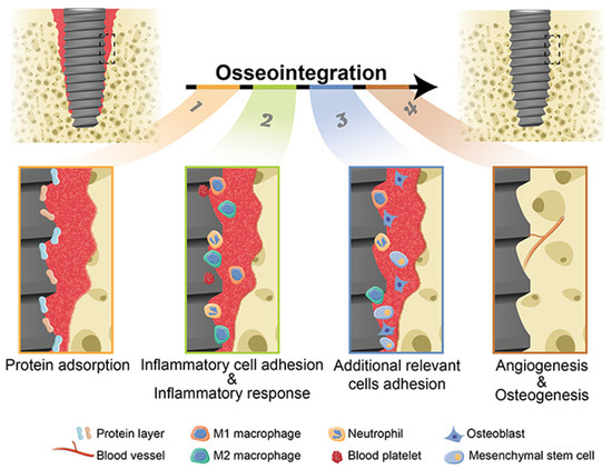 Biomimetic Coatings in Implant Dentistry: A Quick Update