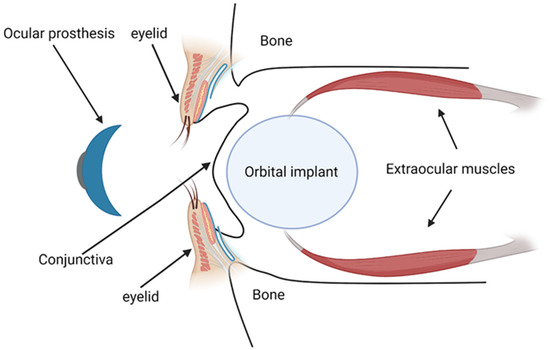 The Use of Functional Biomaterials in Aesthetic and Functional ...