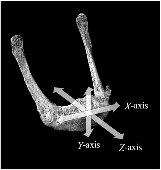 Analysis of Bone Mineral Density and Bone Quality of Cortical Bone in ...