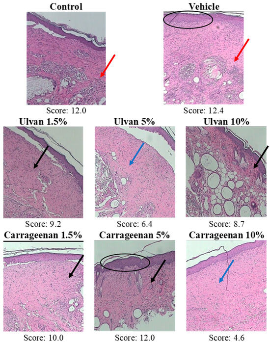 Healing Potential of the Marine Polysaccharides Carrageenan and Ulvan ...