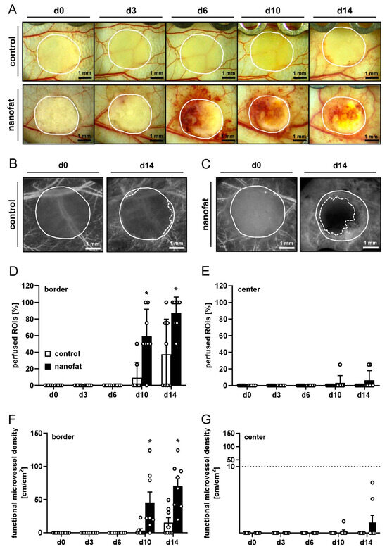 Nanofat Improves Vascularization and Tissue Integration of Dermal ...
