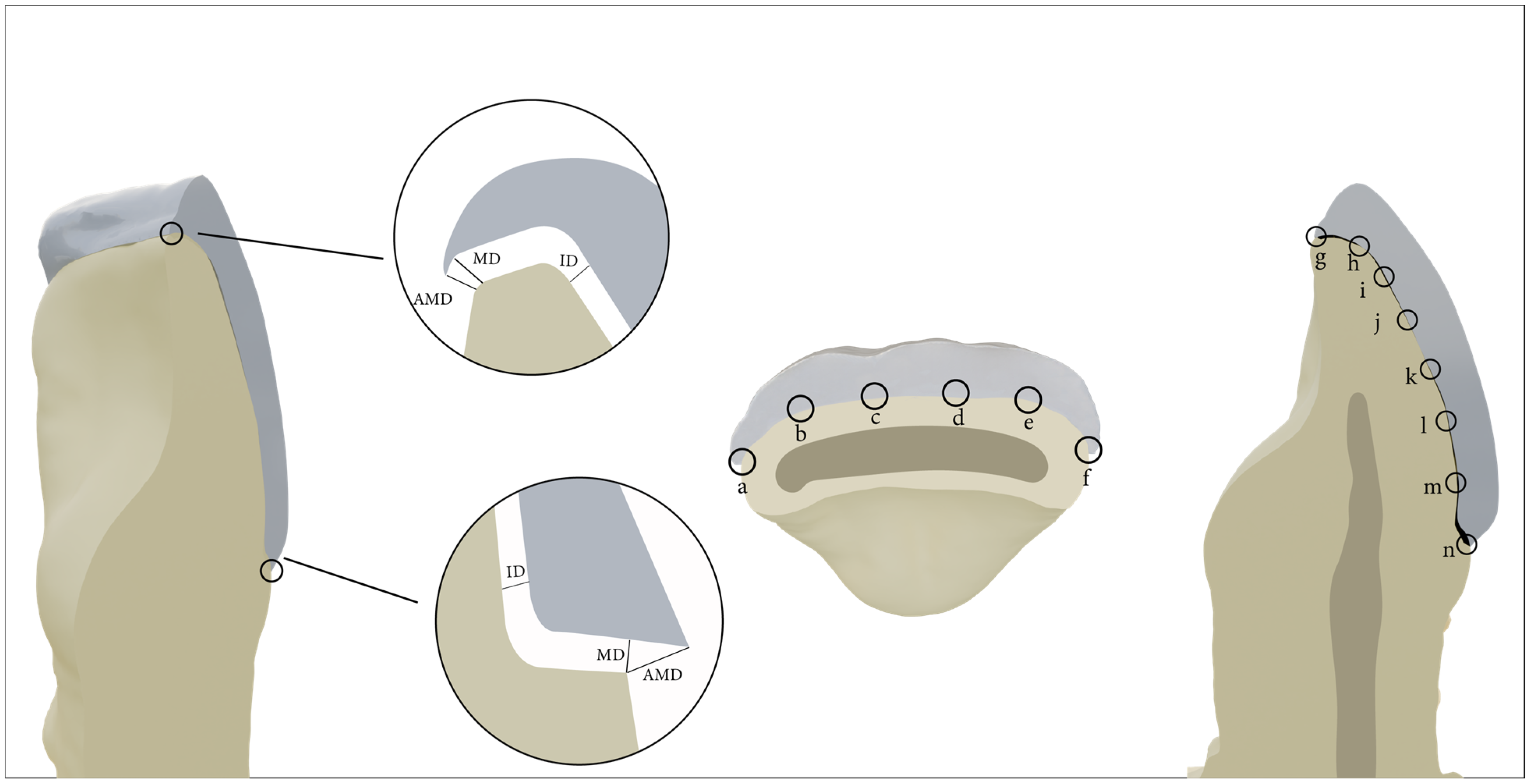 Marginal Discrepancy and Internal Fit of 3D-Printed Versus Milled ...