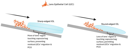 Innovative Polymeric Biomaterials for Intraocular Lenses in Cataract ...
