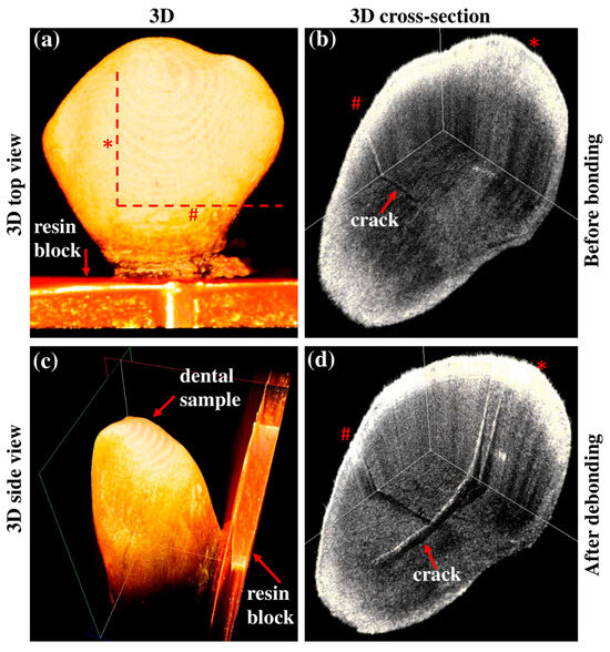 Three-Dimensional Assessment of Dental Enamel Microcrack Progression ...