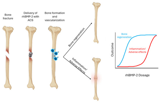 A Critical Review of Commercial Collagen-Based Scaffolds in Bone ...