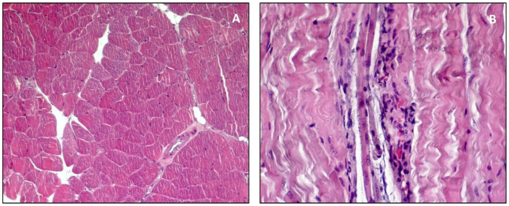 Morphological and Functional Aspects of Human Skeletal Muscle