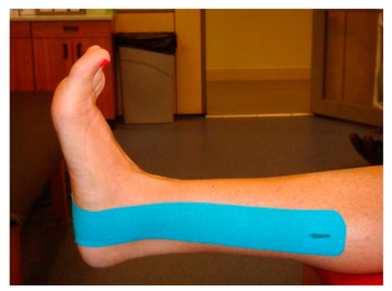 Jfmk Free Full Text Effect Of Kinesio® Taping On Ankle Complex