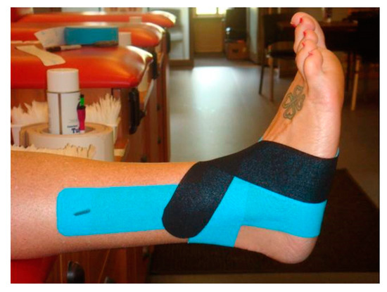 Ankle Taping Diagram