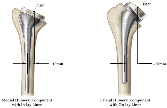 Reverse Shoulder Arthroplasty Biomechanics
