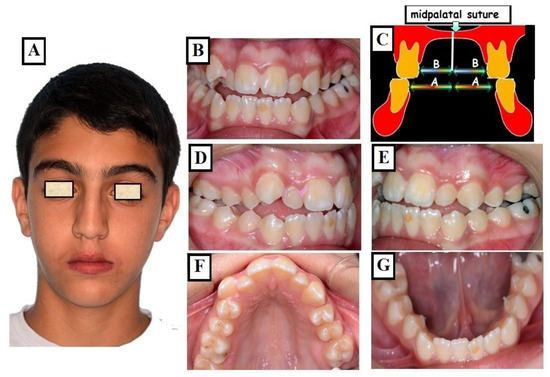 The Complexity of Skeletal Transverse Dimension: From Diagnosis ...