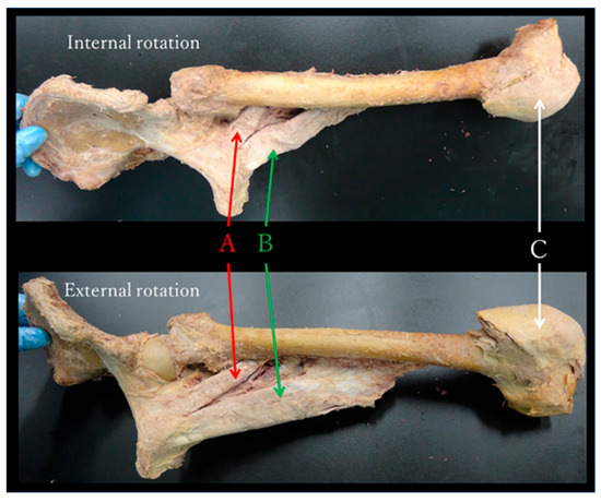 Toward a Better Understanding of Hip Adductor Function: Internal ...