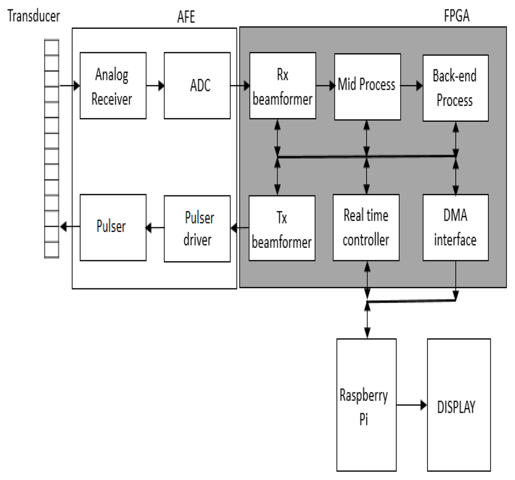 FPGA-Based Portable Ultrasound Scanning System with Automatic Kidney Detection